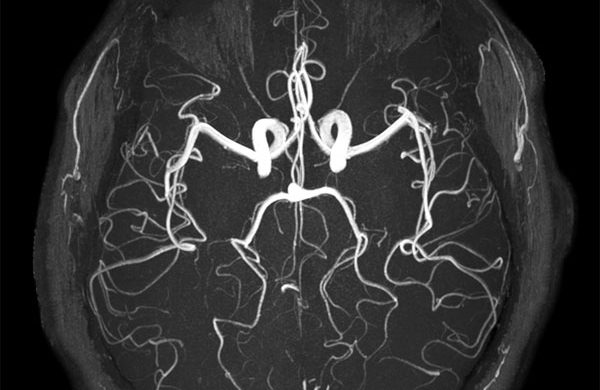 Examen MRA - Unique Imaging